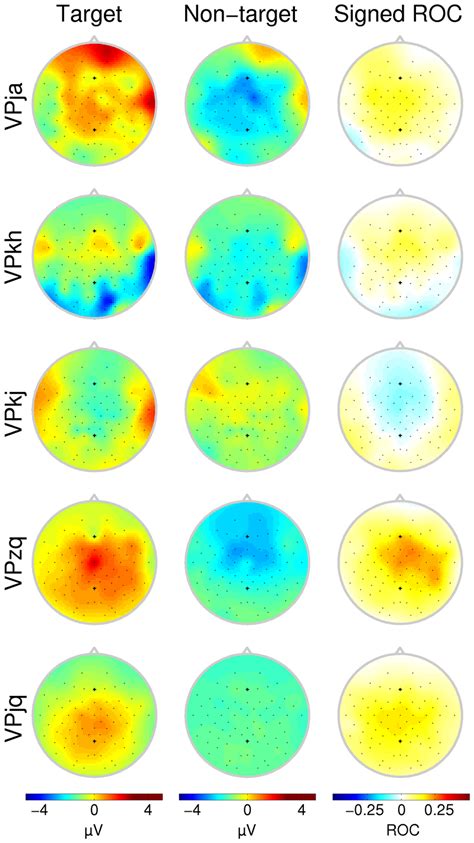 Scalp Topographies For The P300 Interval Condition C175 Scalp Download Scientific Diagram