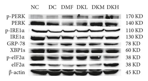 effects of kwz treatment on er stress in the livers of diabetic db db