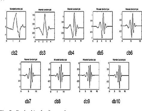 Figure 1 From Simulation For Design The Compressed Ecg Signal