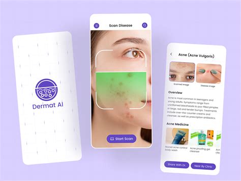 Dermat Ai Skin Disease Scan App By 300mind Ui Ux For 300mind On Dribbble