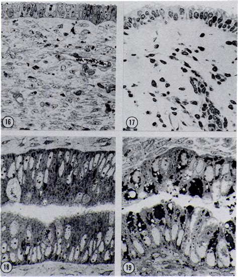 Endometrium Late Proliferative Stage Zone I Consists Of A Thin Band Download Scientific