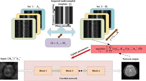 Image Reconstruction With Self Partition Undersampled K Space Data