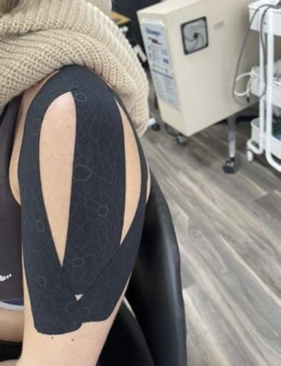 Kinesiology Tape For Shoulder Subluxation
