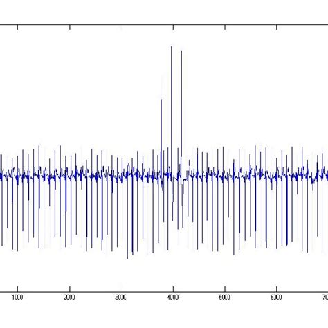 FFT For The ECG Signal Of A Normal Healthy Person Download Scientific Diagram