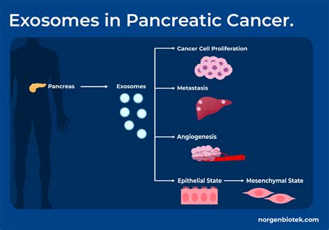 Pancreatic Cancer Causes Symptoms And Effective Treatments Norgen