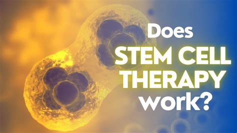 Stem Cell Therapy Great Scam Or A Miraculous Treatment National Stem