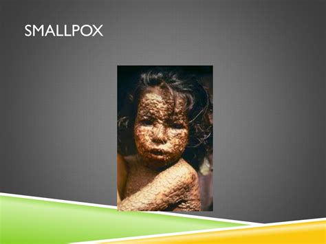 Ppt History Of Microbiology Powerpoint Presentation Free Download