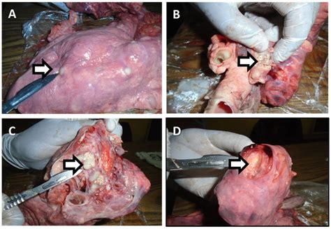 Bovine Tuberculosis In Humans