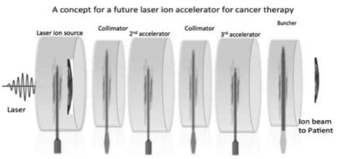 Concept Of An Example Future Laser Ion Accelerator For Ion Beam Cancer