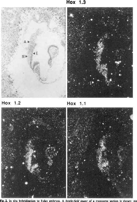 Figure 1 From Anterior Boundaries Of Hox Gene Expression In Mesoderm