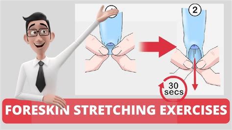 Phimosis Treatment Stretching Exercise Kit For Tight 54 Off