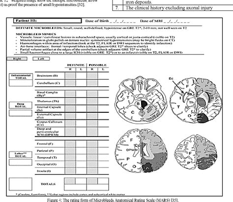 Figure 4 From Cerebral Microbleeds Cmb From Mri Brain Images Review Paper Semantic Scholar