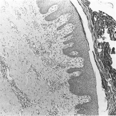 Pdf Staphylococcus Hyicus Virulence In Relation To Exudative