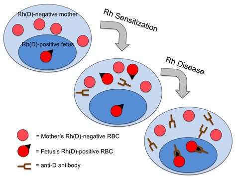 Using Rh Immune Globulin In Pregnancy To Prevent Rh Disease Atlas Of Science