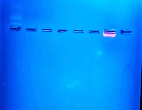 Molecular Biology Troubleshooting Agarose Gel Electrophoresis