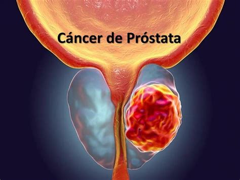 Los 5 Mayores Retos En La Salud Varonil Jof