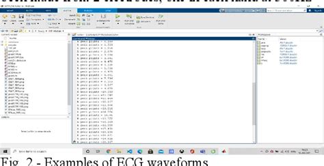 Figure 2 From Detection Of Cardiac Arrhythmias In Electroc Ardiograms Using Deep Learning
