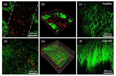New Paper Is Published In Journal Of Biomedical Optics
