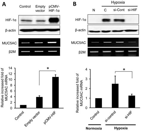 When Hif 1α Expression Is Increased Muc5ac Expression Is Induced Download Scientific Diagram