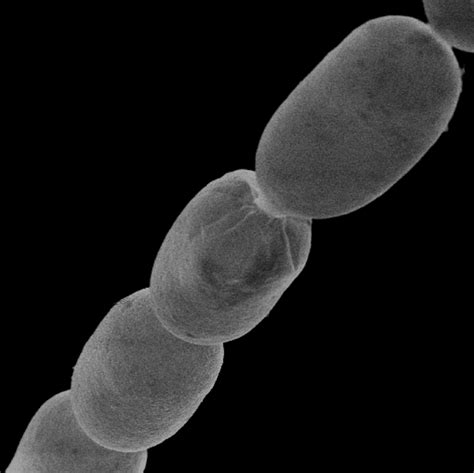 Scientists Discover World S Largest Bacterium That Can Be Seen With Naked Eye See Photos Mint