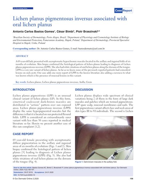 Pdf Lichen Planus Pigmentosus Inversus Associated With Oral Lichen Planus