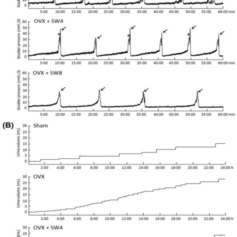 Urodynamic Analysis Of Bladder Cystometric Parameters And Voiding