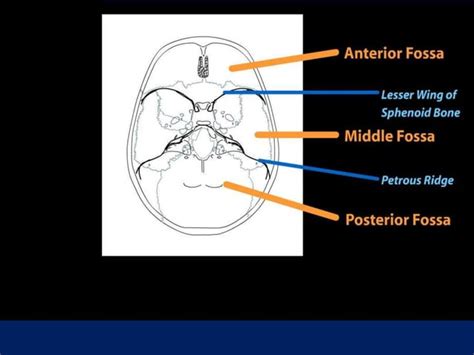 Skull Base Lesion Imagingpptx Ear Nose And Throat Conditions