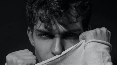 Can Testosterone Levels Really Make You Go Bald