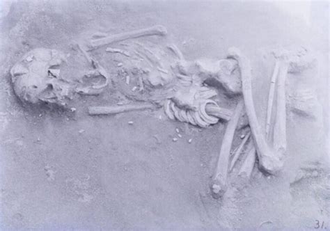 Did The Hirota People Of Japan Intentionally Deform Their Skulls