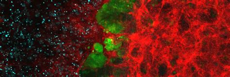 Spatial Omics Platform Irb Barcelona