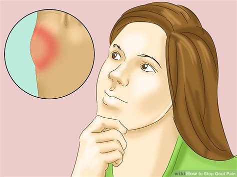 How To Stop Gout Pain 12 Steps With Pictures WikiHow