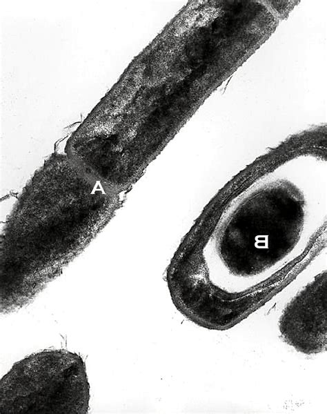 Free Picture Transmission Electron Micrographic Image Bacillus Anthracis Anthrax Culture