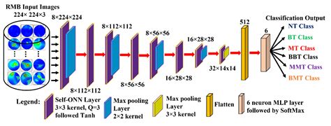 A Lightweight Deep Learning Based Microwave Brain Image Network Model For Brain Tumor
