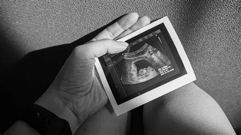 Өдрийн мэнд Гоозул эмэгтэйчүүдийн эмнэлэг