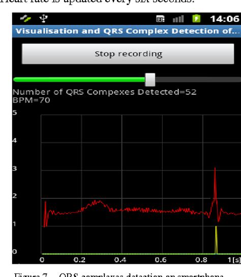 Figure 1 From On Line Ecg Processing And Visualization Using Android Smartphone Semantic Scholar