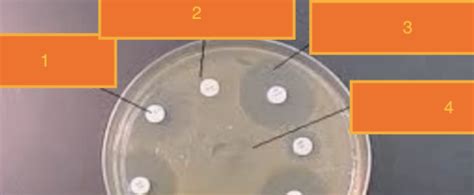 Antibiotic Sensitivity Flashcards Quizlet