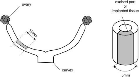 Application Of Detergents Or High Hydrostatic Pressure As