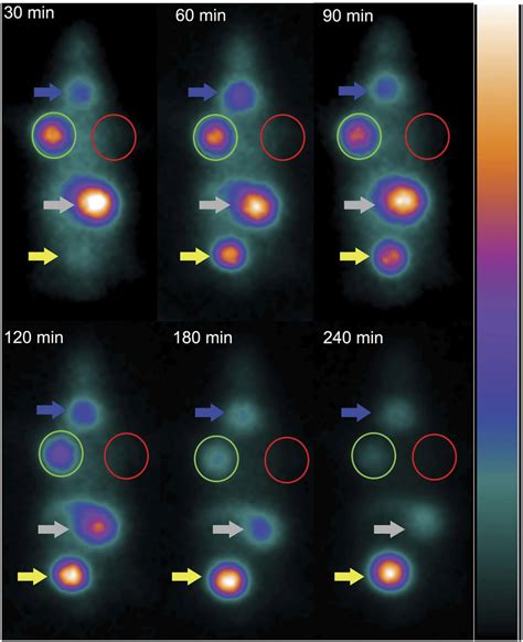 The Dynamic Imaging By Spect Instrument The Imaging Variation Over