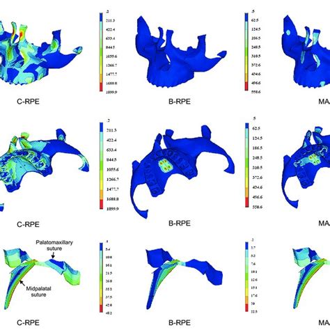 The Finite Element Model Showing The Von Mises Stress Distribution Over