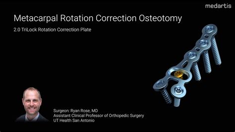 Metacarpal Rotation Correction Osteotomy Youtube