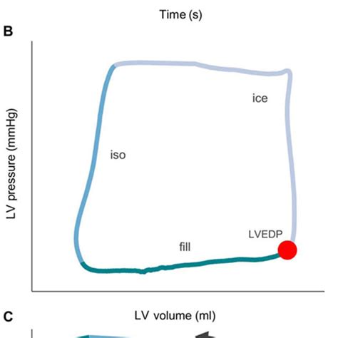 The Cardiac Cycle Separated Into Phases Of Ventricular Isovolumetric Download Scientific
