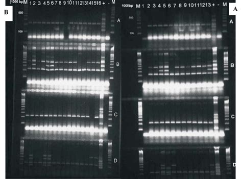 Toxins Produced By Mssa And Mrsa Isolates Download Scientific Diagram