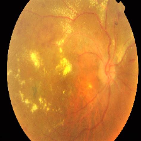 Custom Workflow Single Label Classification Classification Dataset By