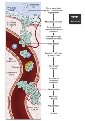 Tumour Behaviour And Spread Flashcards Quizlet