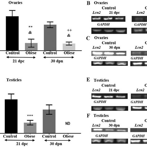 Lcn Expression Levels In The Gonads Of Prepubertal Offspring Of Download Scientific Diagram