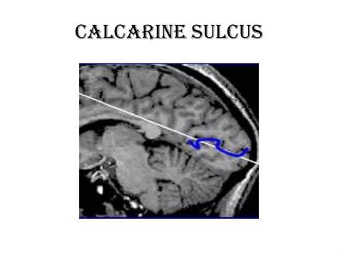Anatomy Of Brain Sulcus And Gyrus Dr Sajith Md Rd Pptx Brain And