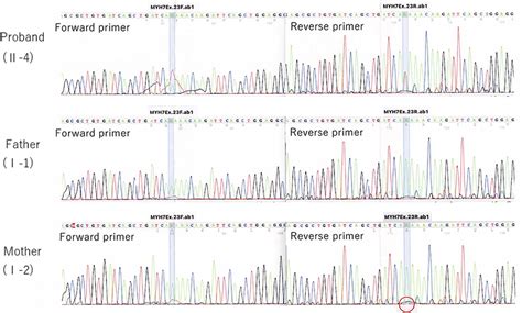 Direct Sequencing Trio Analysis Chromatograms A Red Circle Indicates A Download Scientific
