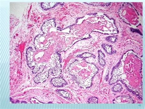 Odontogenic Tumor 2022pptx Dental Health Diseases And Conditions