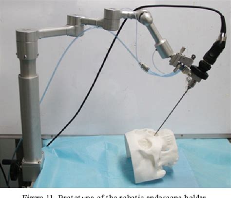 Figure 11 From Design Of A Robotic Endoscope Holder For Sinus Surgery