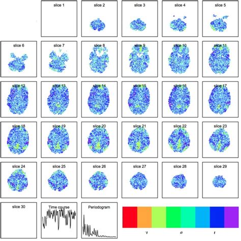 Spatial Map Produced By Independent Components Analysis Within R Each